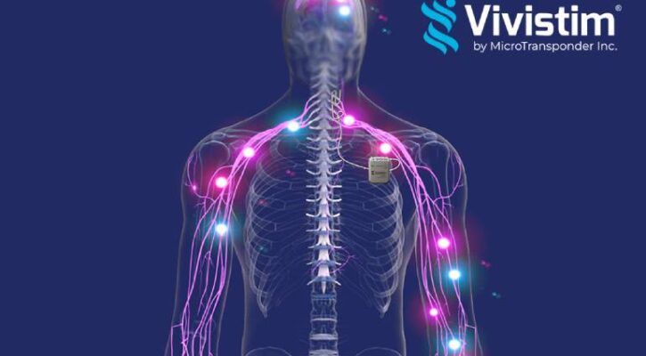 MassDevice Logo & Brand Assets (SVG, PNG and vector) - Brandfetch