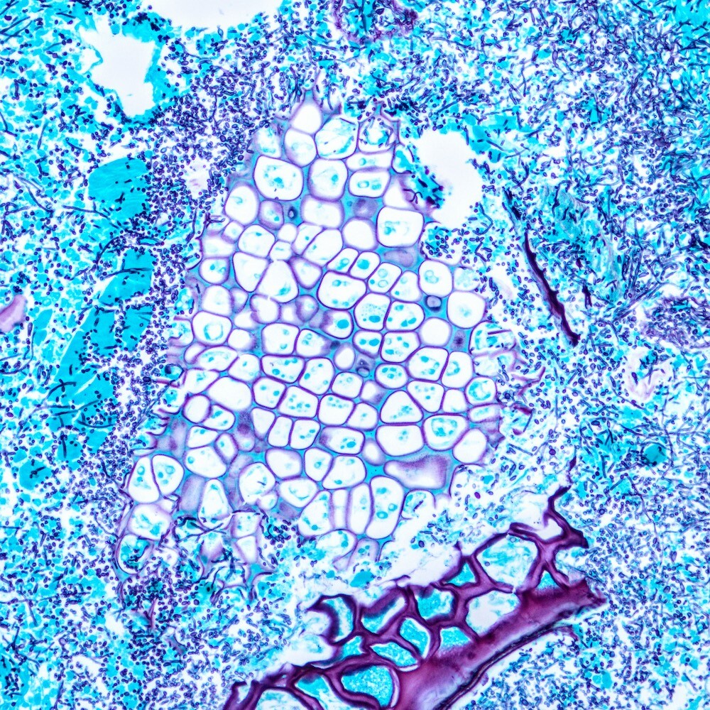 PathologyOutlines.com Logo & Brand Assets (SVG, PNG and vector ...